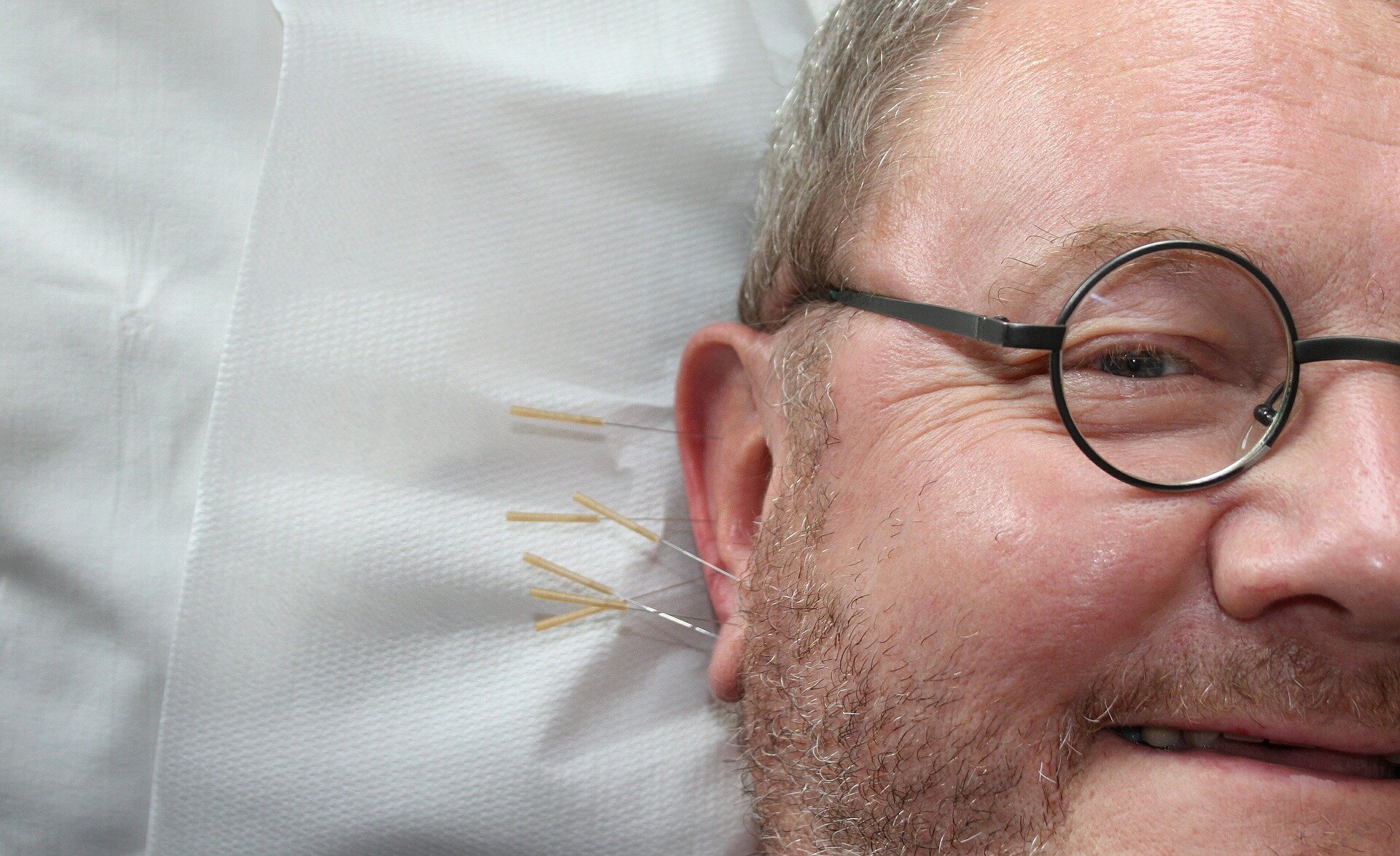 Needles in my ear? Say "What"????? - Acupuncture Clinic of Boulder