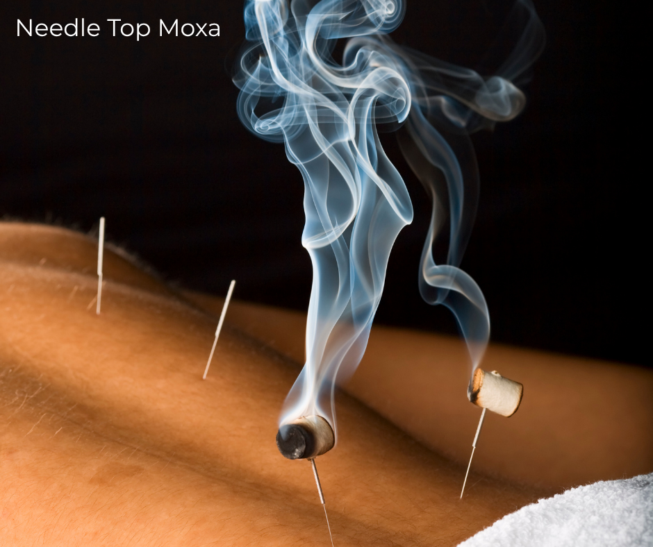 What’s That Smell? It Might Be Moxa! - Acupuncture Clinic of Boulder